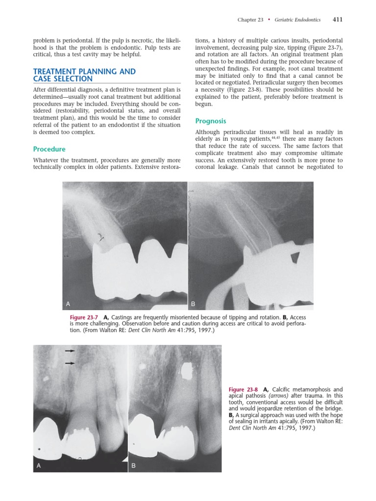 Endodontics Principles and Practice (430 497) | PDF | Mouth | Dentistry