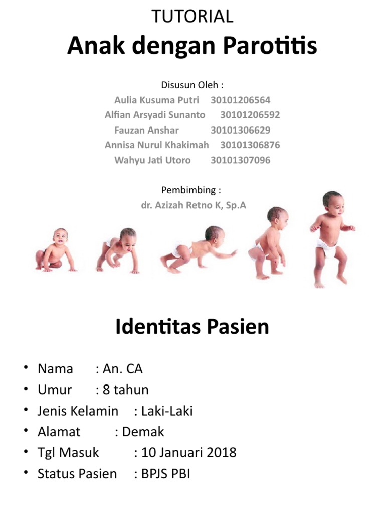 Parotitis pada Anak | PDF
