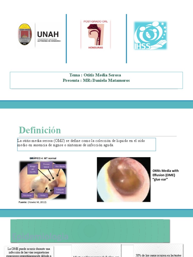 Otitis Media Serosa | PDF | Medicina CLINICA | Cabeza y cuello humanos