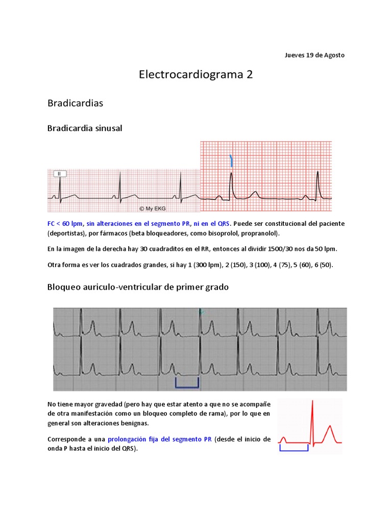 Electrocardiograma 2 | PDF | Electrocardiografia | Fisiología
