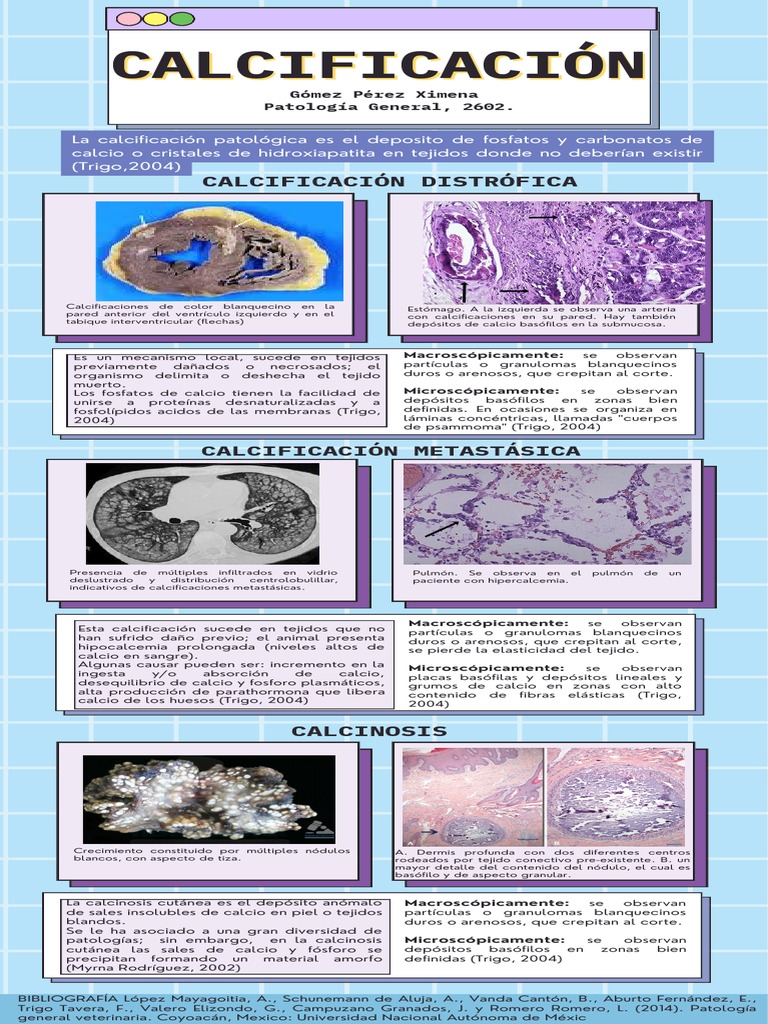 Tipos de Calcificación Patológica | PDF | Calcio | Medicina CLINICA