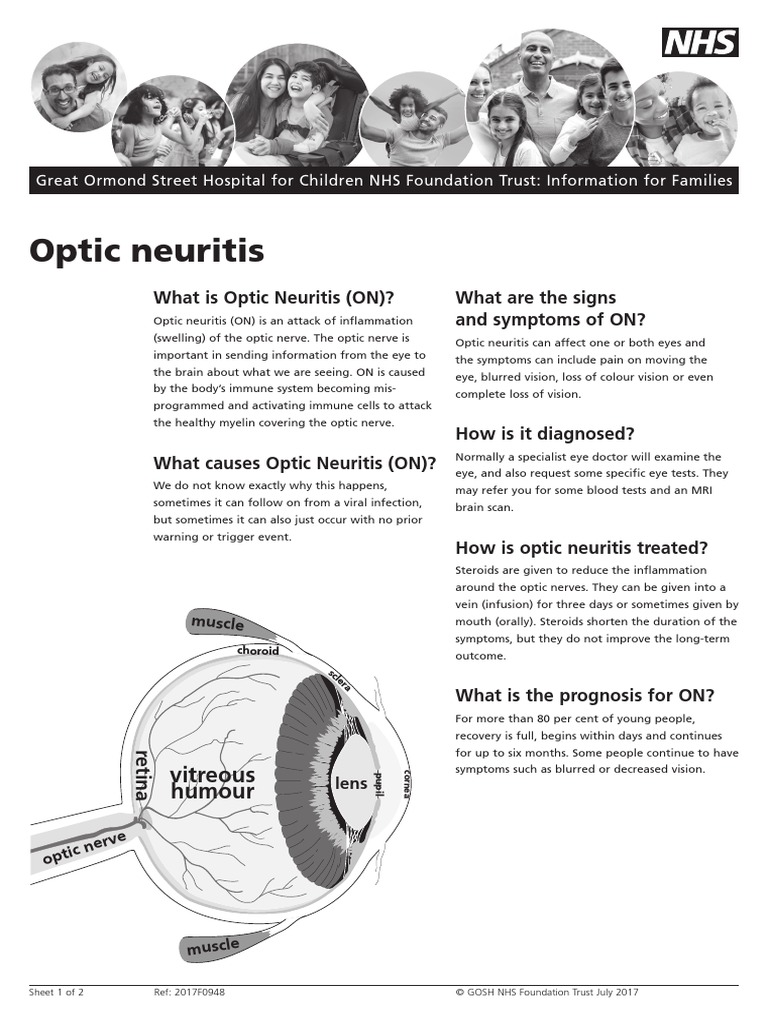 Optic Neuritis F0948 A4 BW FINAL Jul17 | PDF | Multiple Sclerosis | Myelin