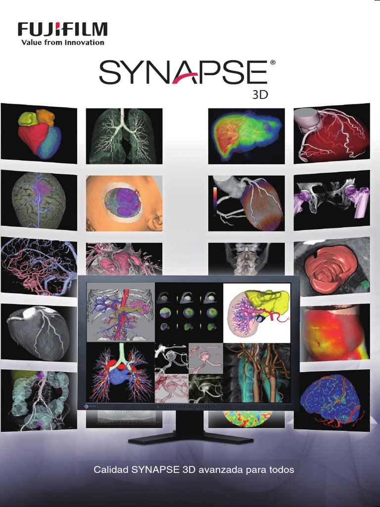 Folleto Traducido para La Web Fujifilm Synapse 3D v5 4pages | PDF | Ct Scan | Imagen de ...