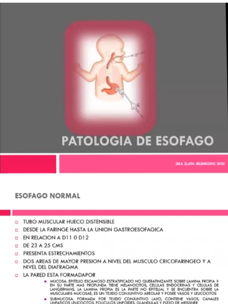 Patologías Del Esofago | PDF
