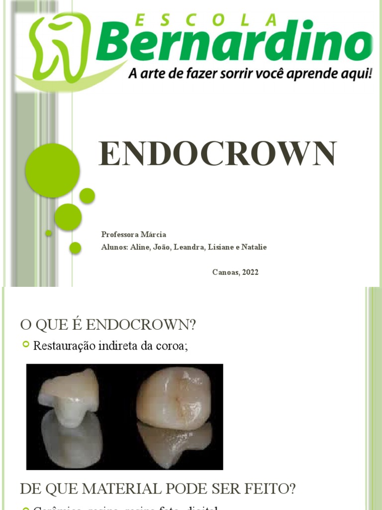 Preparação e Indicações da Endocrown | PDF
