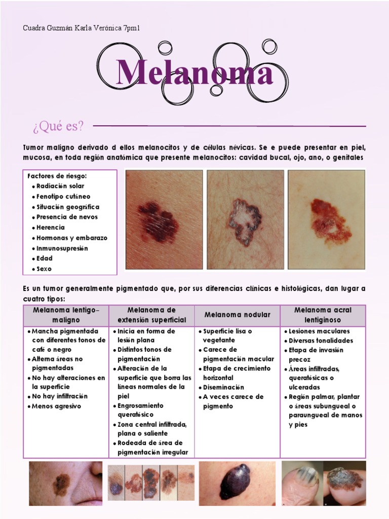 Trabajo Final Derma 2 | PDF | Piel | Cáncer