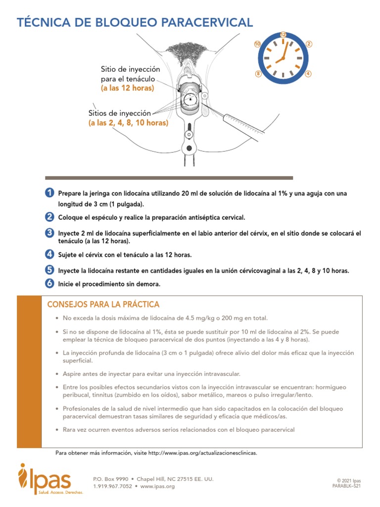 Tecnica de Bloqueo Paracervical PARABLK S21 | PDF | Inyección (medicina ...