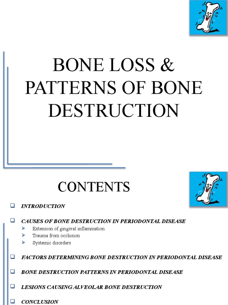 Third Year Class Bone-Loss-Patterns | PDF | Periodontology | Bone