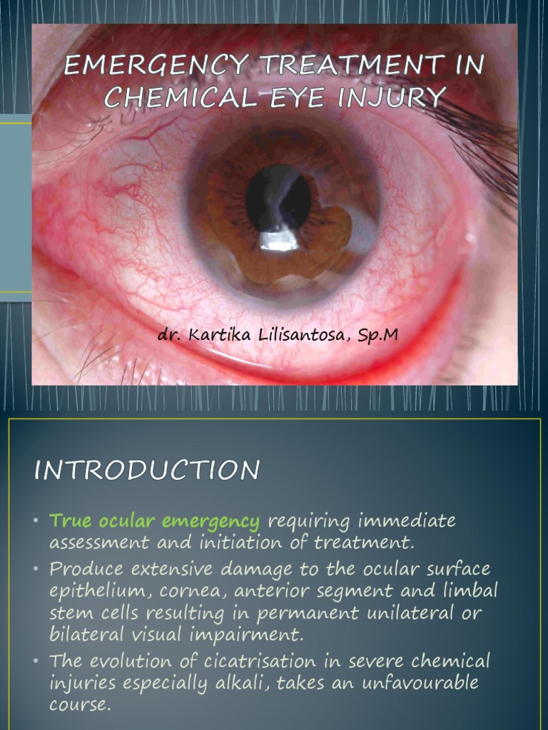 Emergency Treatment in Eye Chemical Injury | PDF | Cornea | Wound Healing