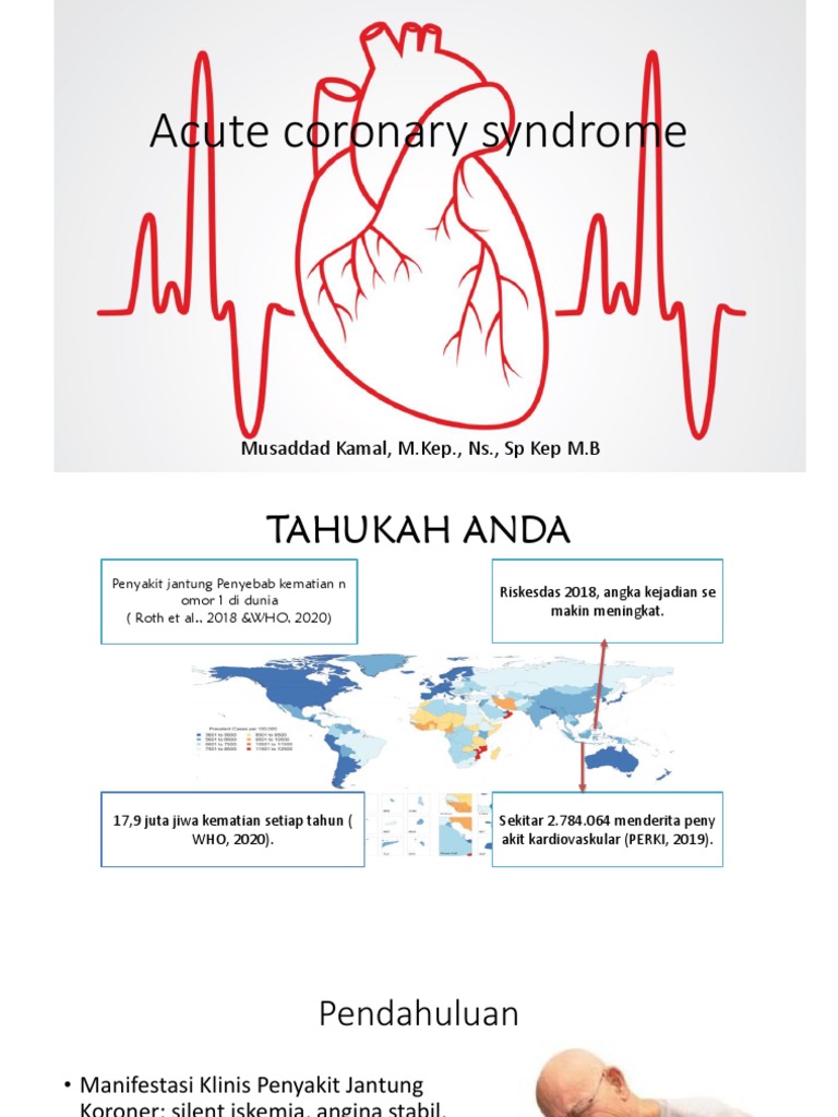 Acute Coronary Syndrome | PDF