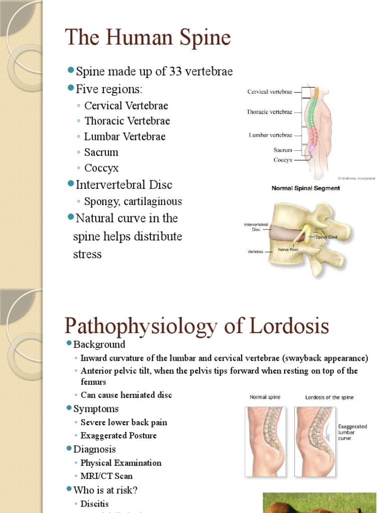 Lordosis | PDF