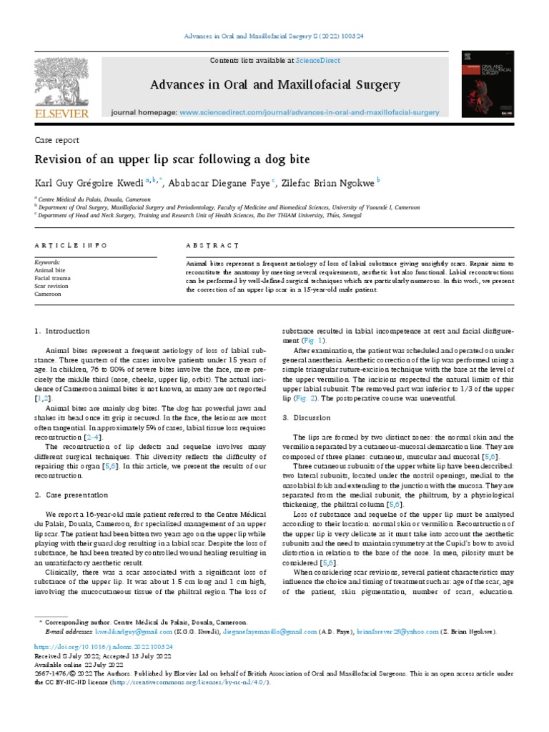 Revision of An Upper Lip Scar Following - 2022 - Advances in Oral and ...