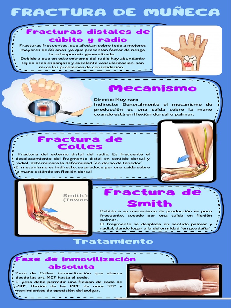 Fracturas de muñeca: Colles y Smith | PDF | Mano | Codo