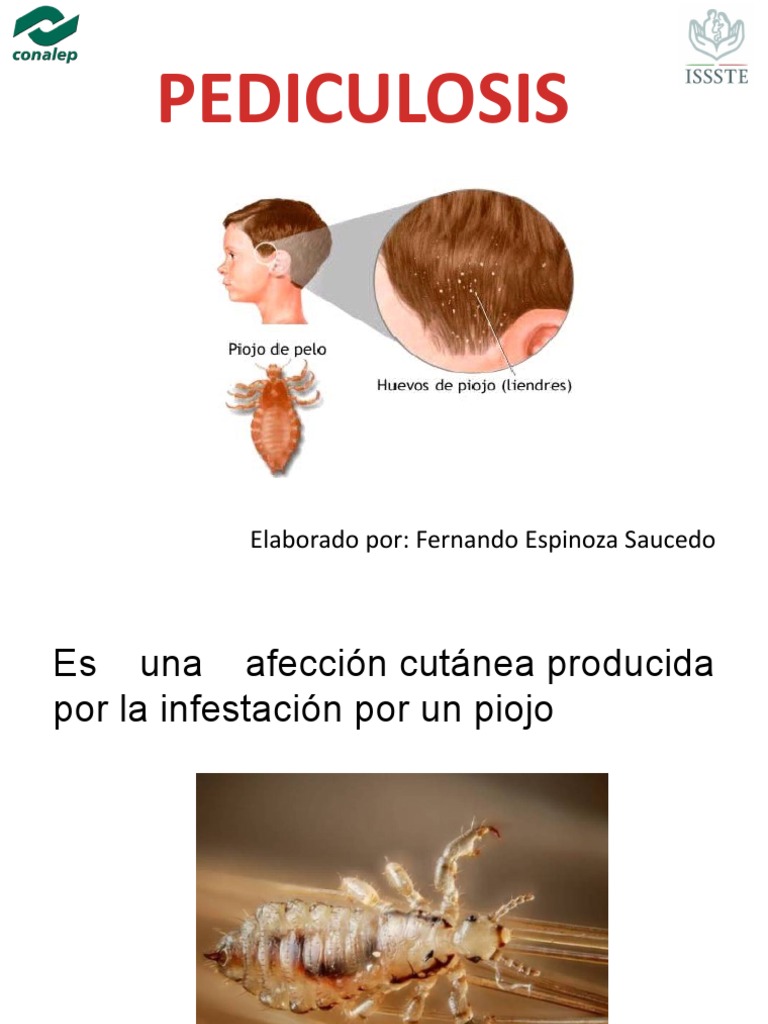 Características y tratamiento de pediculosis | PDF | Hogar, jardinería ...
