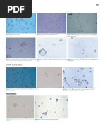 Urine Sediment Atlas: Key Points | PDF | Medical Specialties | Clinical ...