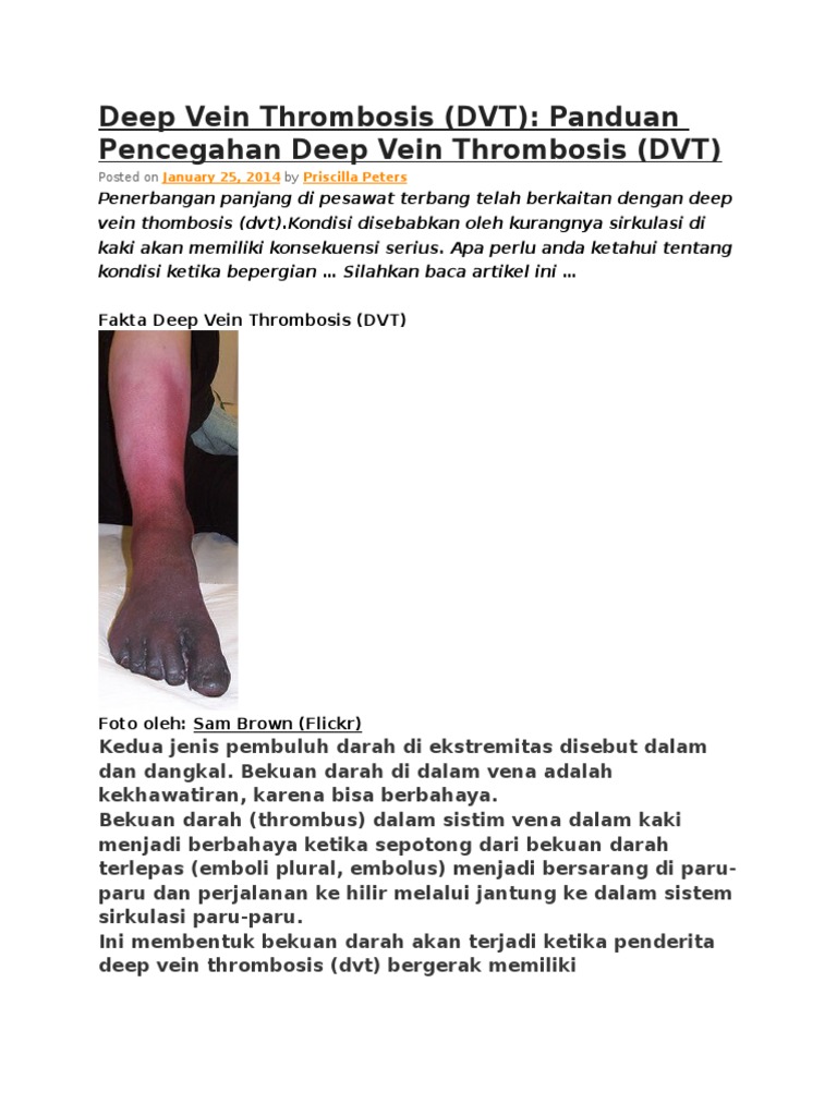 Panduan Gejala dan Penyebab DVT | PDF