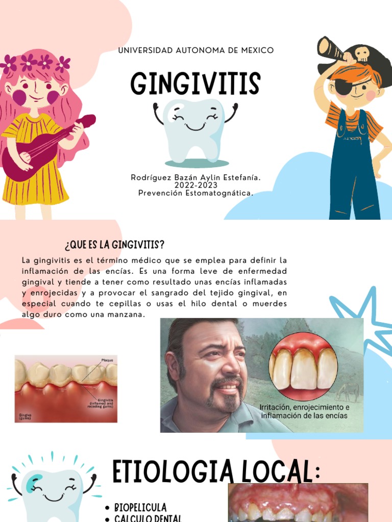 Gingivitis | PDF