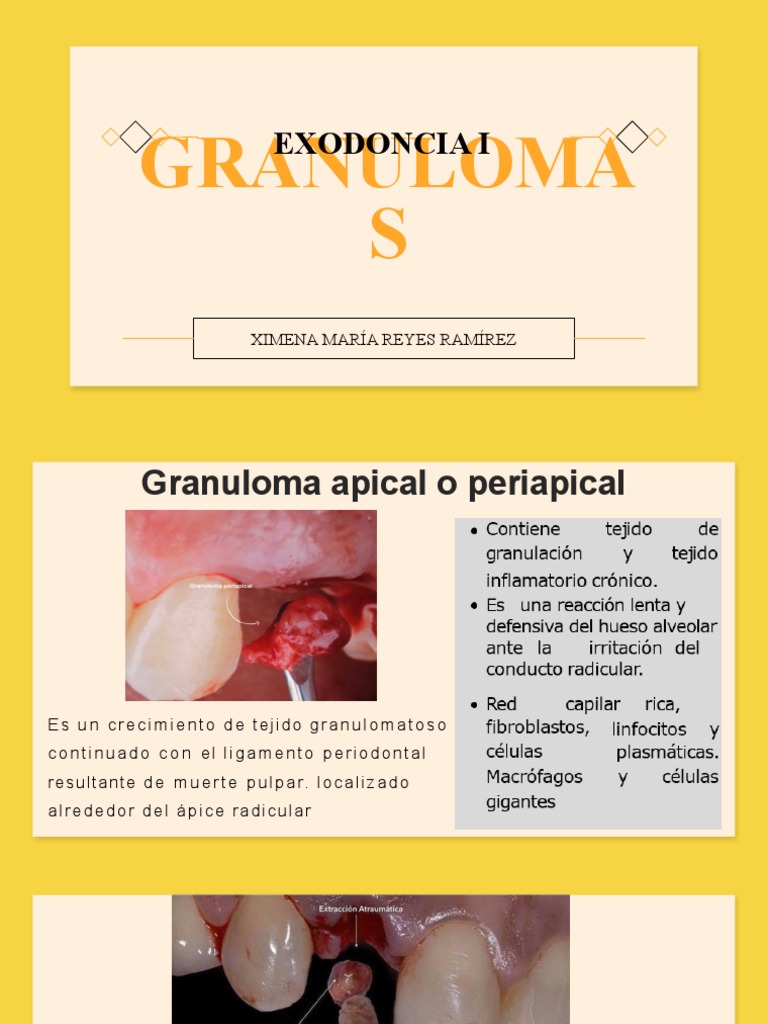 Granuloma | PDF | Odontología | Inflamación