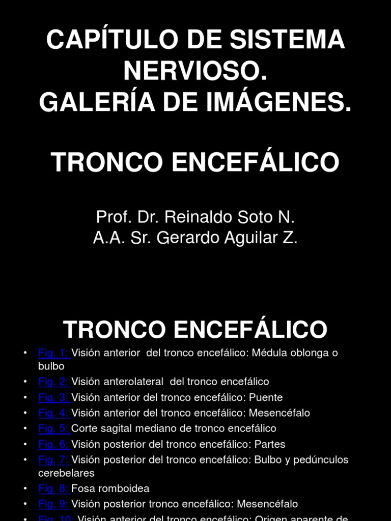Tronco Encefálico | PDF | Cerebelo | Tronco encefálico