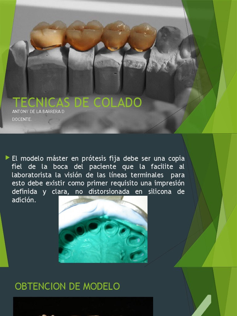 Tecnicas de Colado y Modelos de Fija | PDF | Dentadura postiza | Rieles