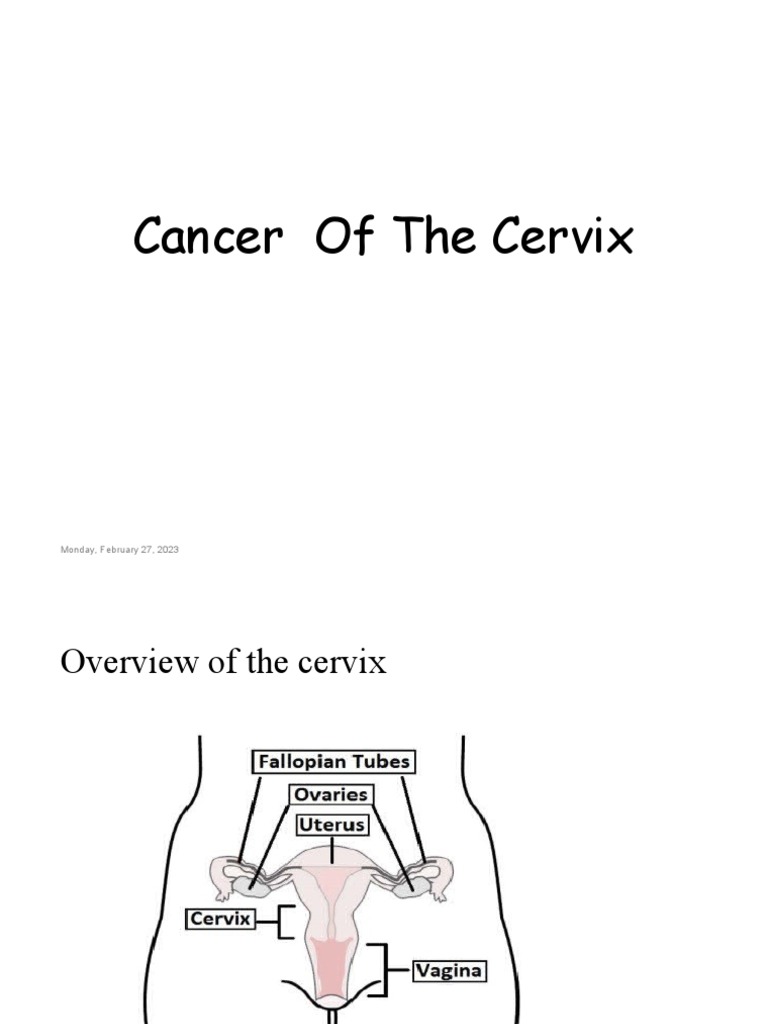Ca Cervix 1 | PDF | Cervical Cancer | Uterus