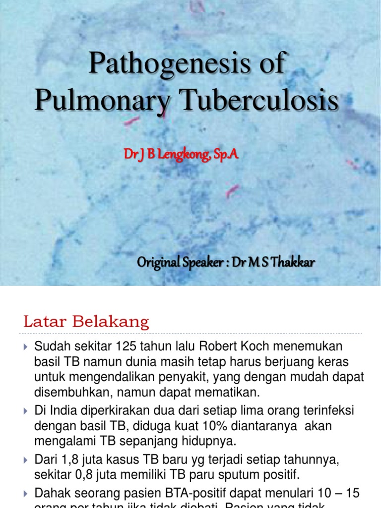 Pathogenesis of Pulmonary Tuberculosis: DR J B Lengkong, Sp.A | PDF ...