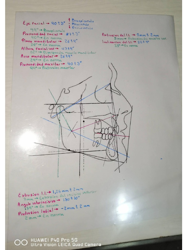 Análisis Cefalometrico de Ricketts | PDF