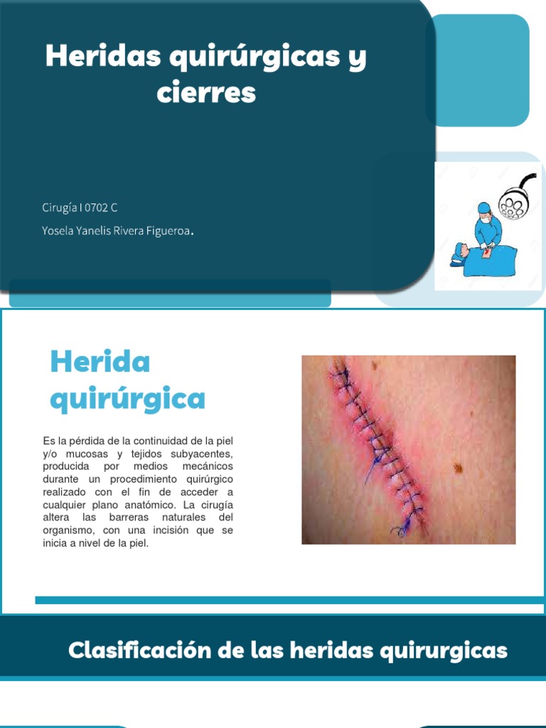 Heridas Quirurgicas y Cierres PDF | PDF | Cirugía | Herida