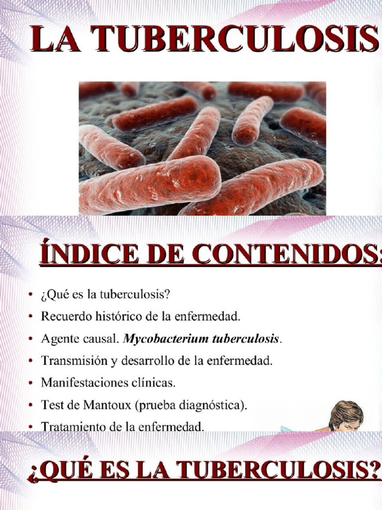 La Tuberculosis | PDF
