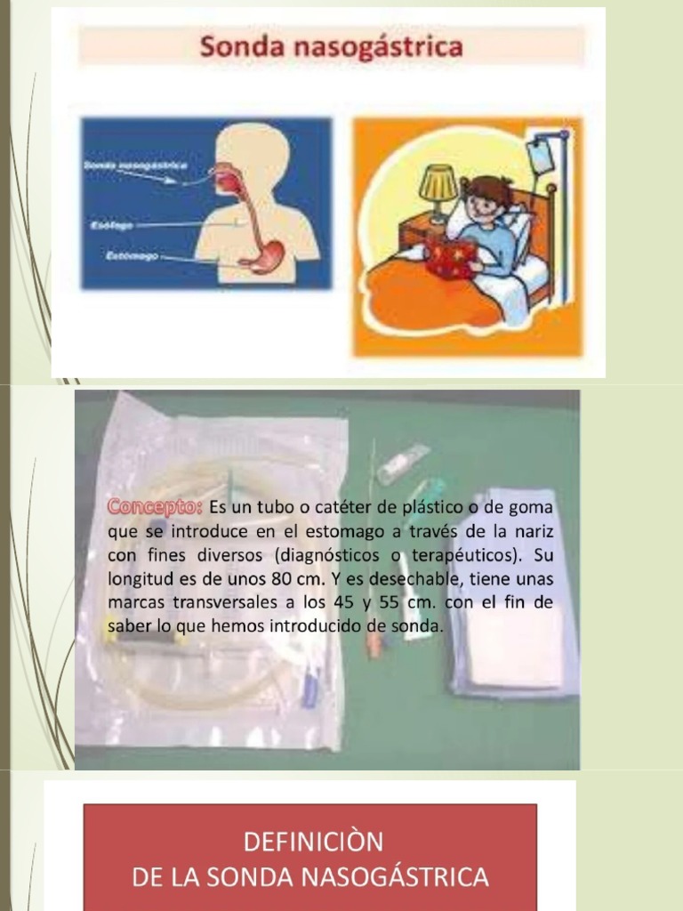 Sonda Nasogastrica Pdf