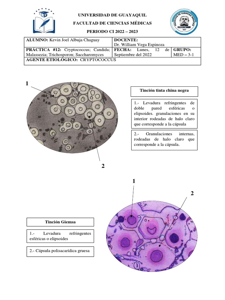 PRACTICA N°12 - DIBUJOS - CRYPTOCOCCUS CANDIDA MALASSEZIA TRICHOSPORON ...