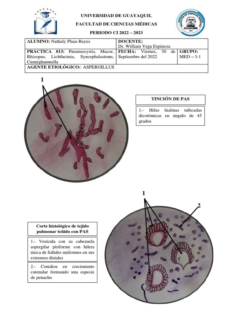 Practica N°13 - Dibujos - Aspergillus Pneumocystis Mucor Rhizopus ...