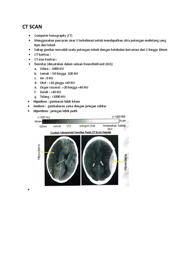 Interpretasi Densitas pada CT Scan | PDF | Perjalanan | Hukum