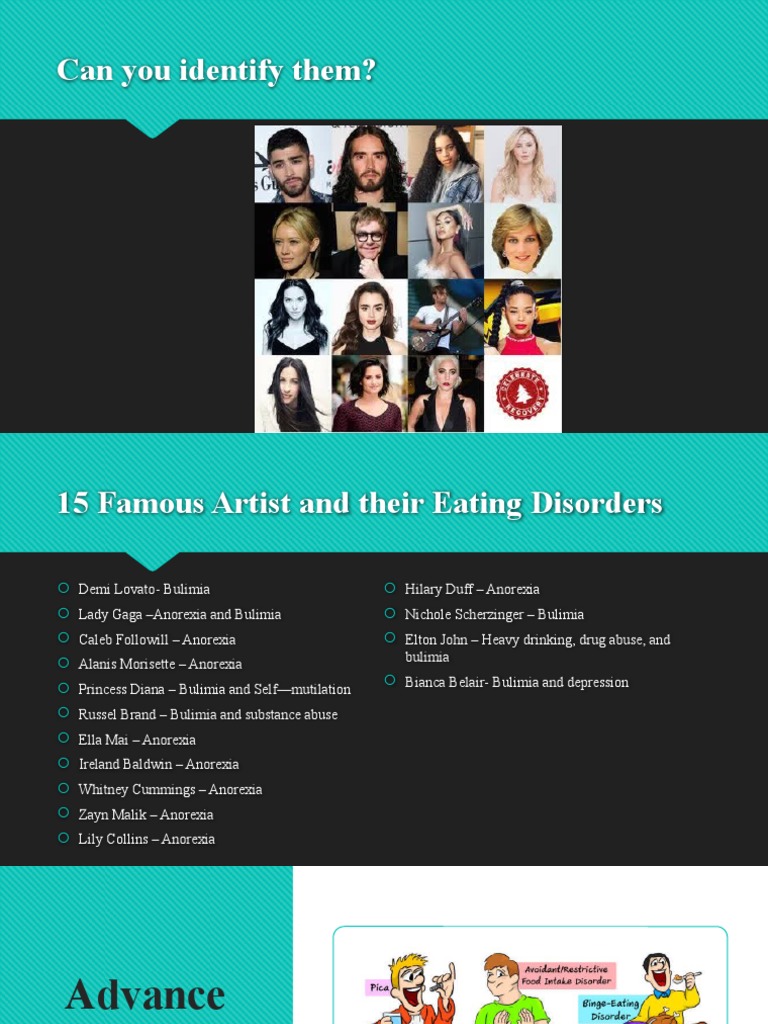 Celebrities & Eating Disorders | PDF | Binge Eating Disorder | Anorexia ...