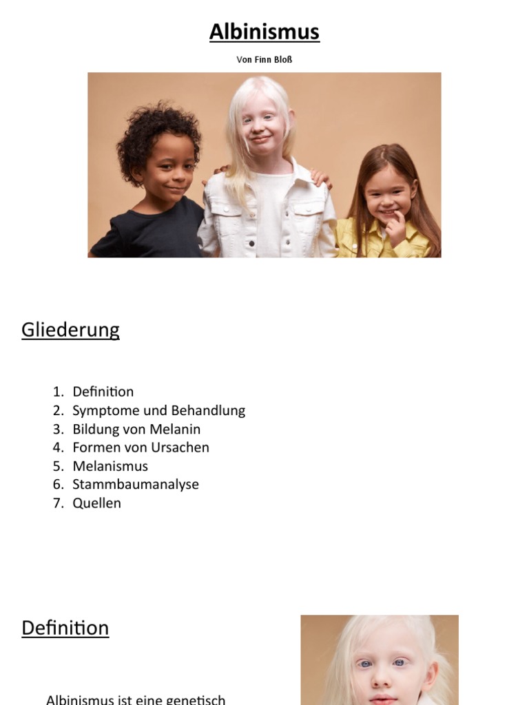 Albinismus | PDF