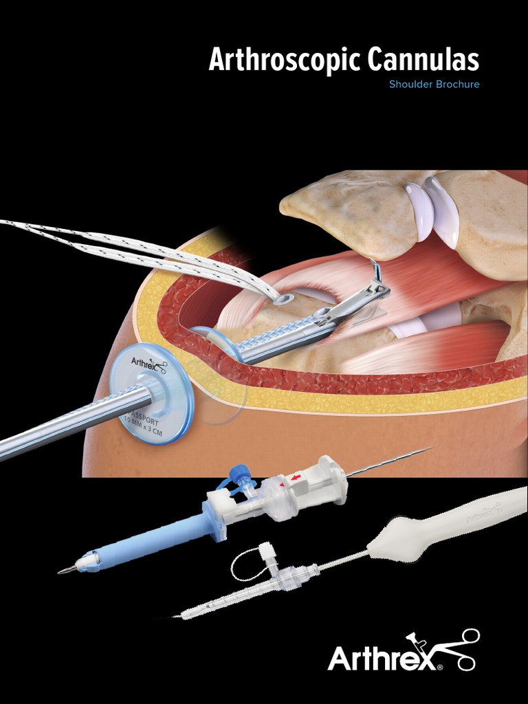 Arthroscopic Cannulas: Shoulder Brochure | PDF | Equipment