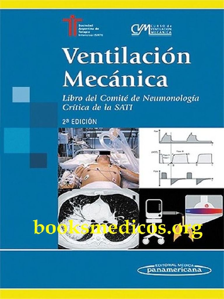 Ventilacion Mecanica SATI | PDF