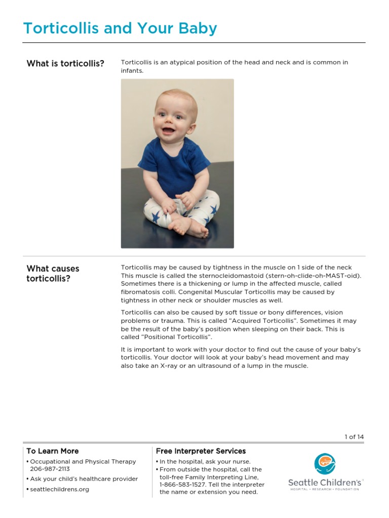 Torticollis and Your Baby | PDF | Musculoskeletal System | Human Anatomy