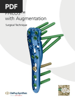 AC Joint Repair Arthrex | PDF | Surgical Suture | Joints