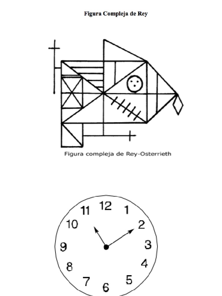 Figura Compleja Del Rey | PDF