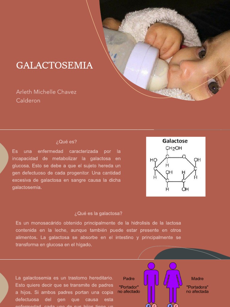 GALACTOSEMIA | PDF