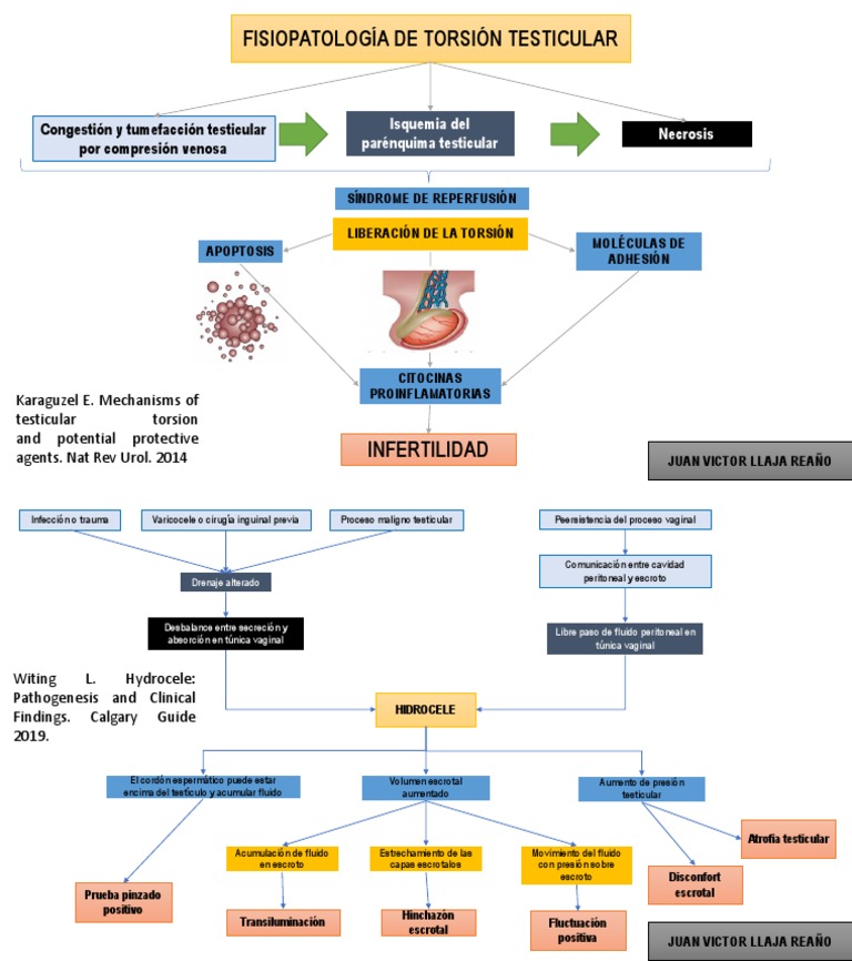 Mapa Torsión Testicular e Hidrocele | PDF | Enfermedades del sistema ...