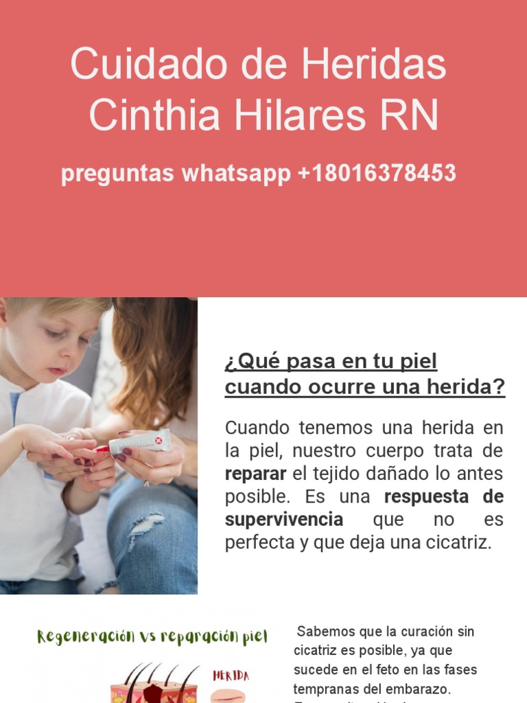 Cuidado de Heridas Cinthia Hilares | PDF | Coagulación | Herida