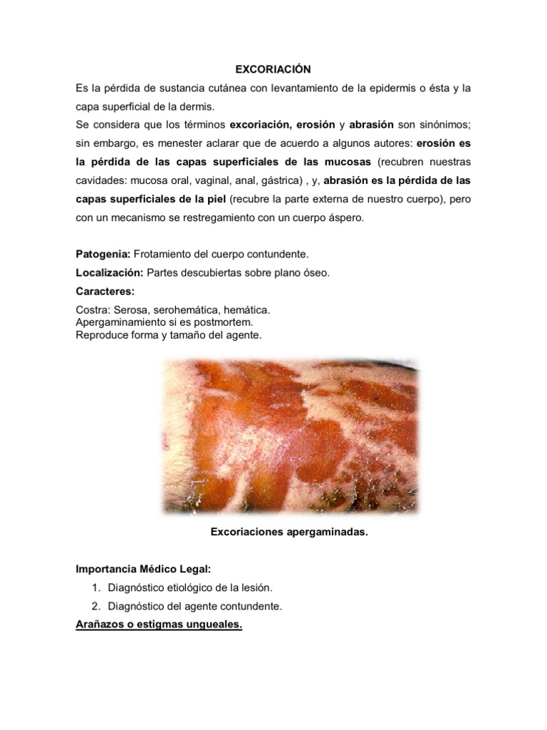 Excoriaciones Tipos Y Tratamientos Pdf Clavo Anatomía Sangre