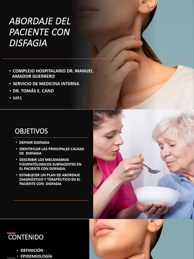 Abordaje Integral de la Disfagia | PDF | Esófago | Causas de la muerte