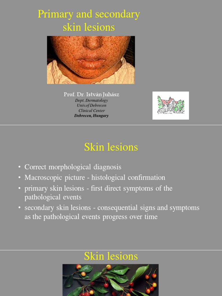Primary and Secondary Skin Lesions | PDF | Skin | Scar