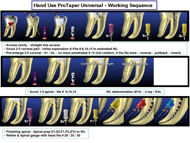 ProTaper Universal Hand Use Sequence | PDF