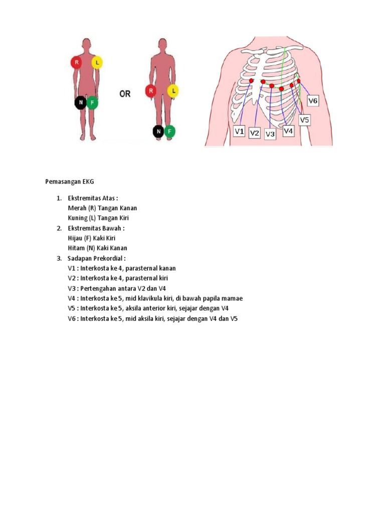 Pemasangan EKG-WPS Office | PDF