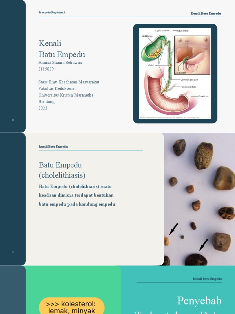 Mengenal Batu Empedu dan Gejalanya | PDF