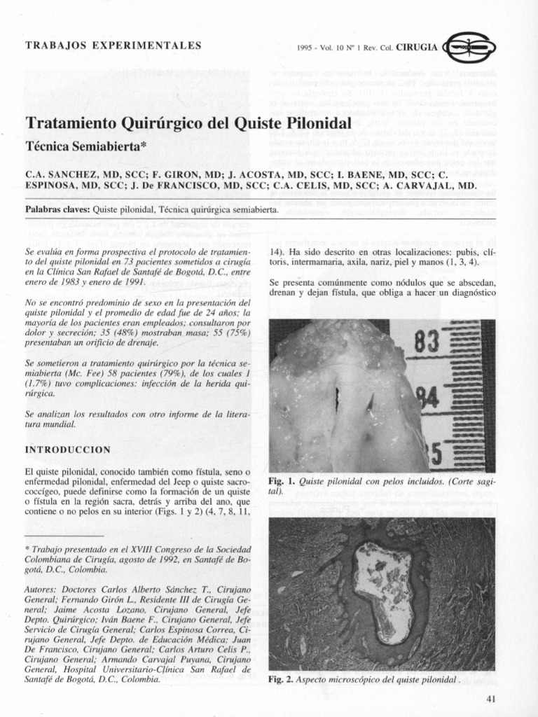 Tratamiento Quirúrgico Del Quiste Pilonidal: Técnica Semiabierta ...